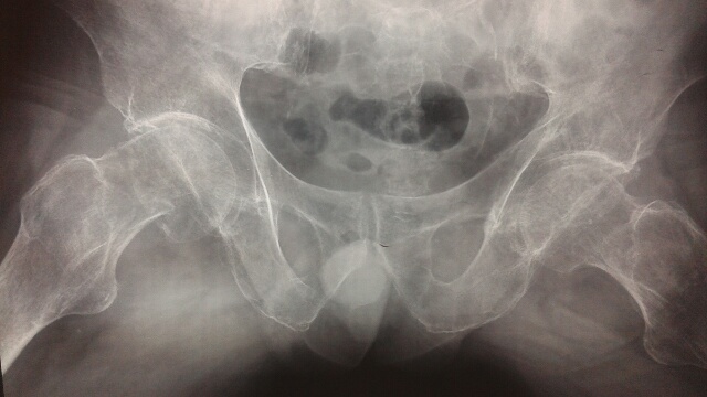 Simple radiology, still valuable – Prodiagnosis / Foro Osler