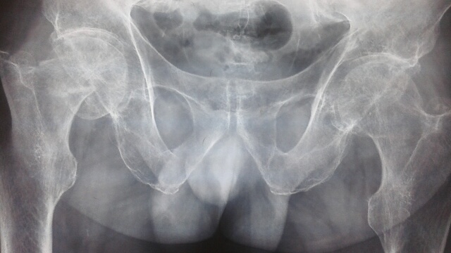 Simple radiology, still valuable – Prodiagnosis / Foro Osler