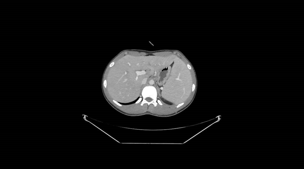 Case Analysis Theater – Prodiagnosis / Foro Osler