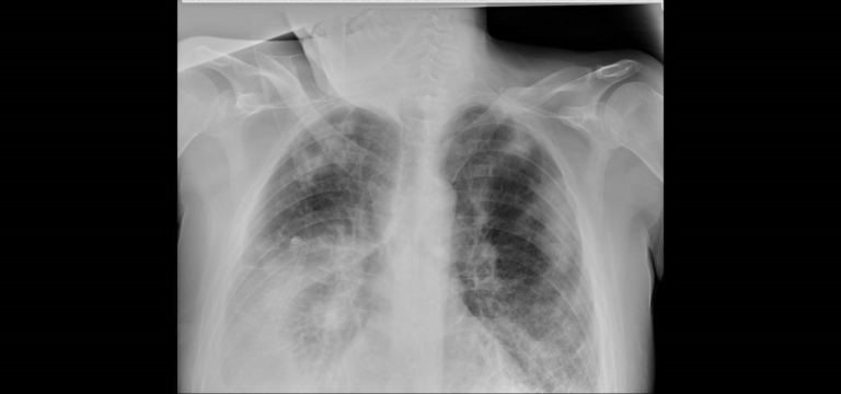 veinte julio22 (2) – Prodiagnosis / Foro Osler