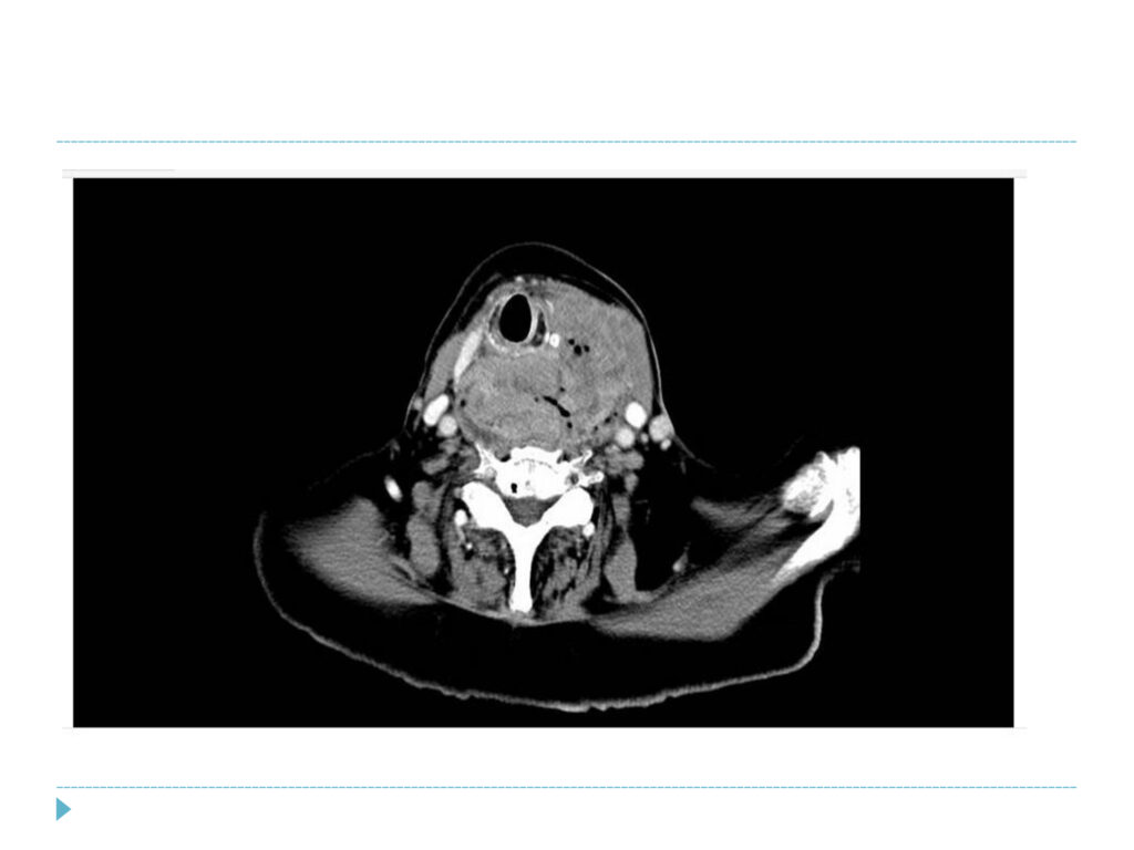 imagen2 – Prodiagnosis / Foro Osler
